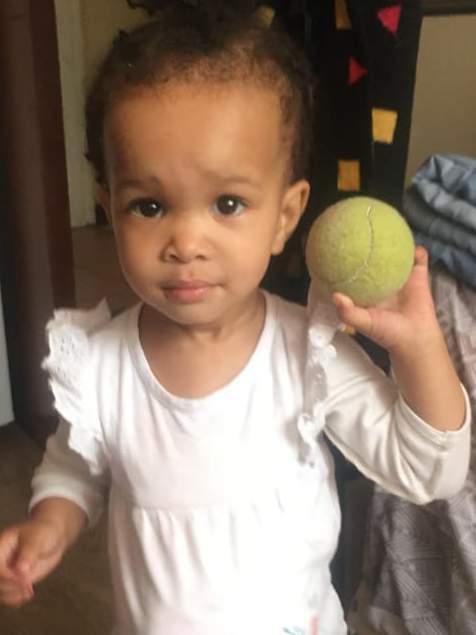 Hope for the little warrior who was born with intestines outside her ...