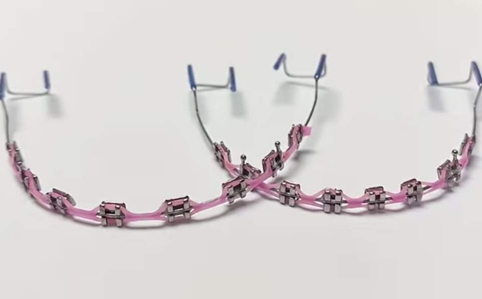 ‘Extremely dangerous’: Experts warn DIY fashion braces trend could ...