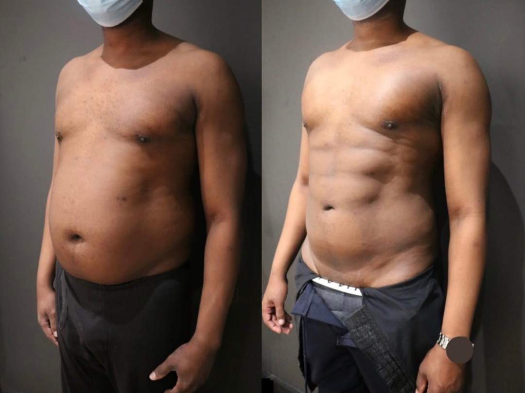 How Jub Jub’s liposuction signals a growing trend of male plastic ...