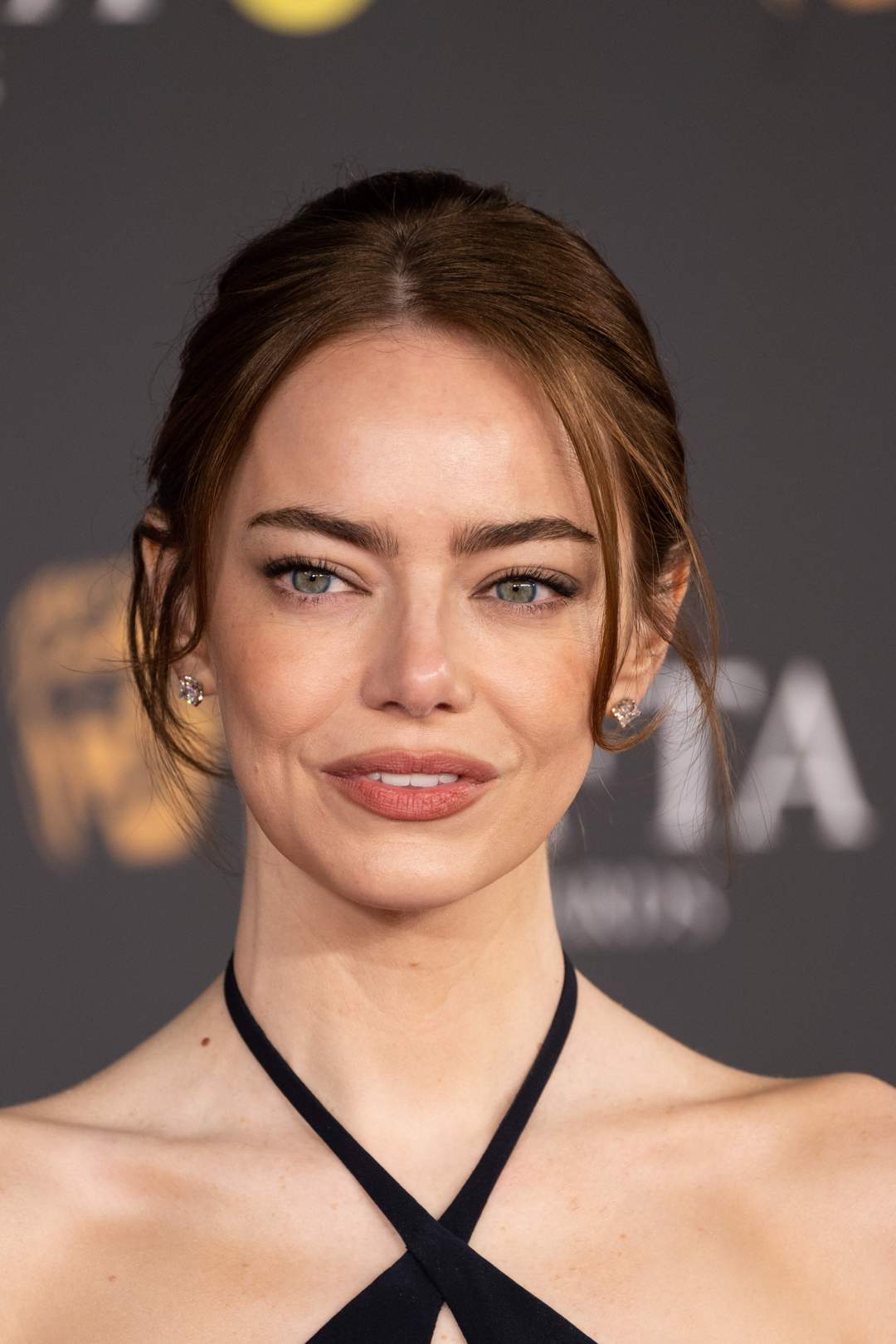 Changing faces of Hollywood: speculation over the altered features of ...