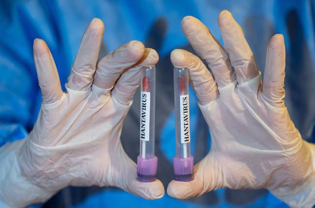 ‘This is not the next COVID’ - WHO epidemiologist addresses growing ...